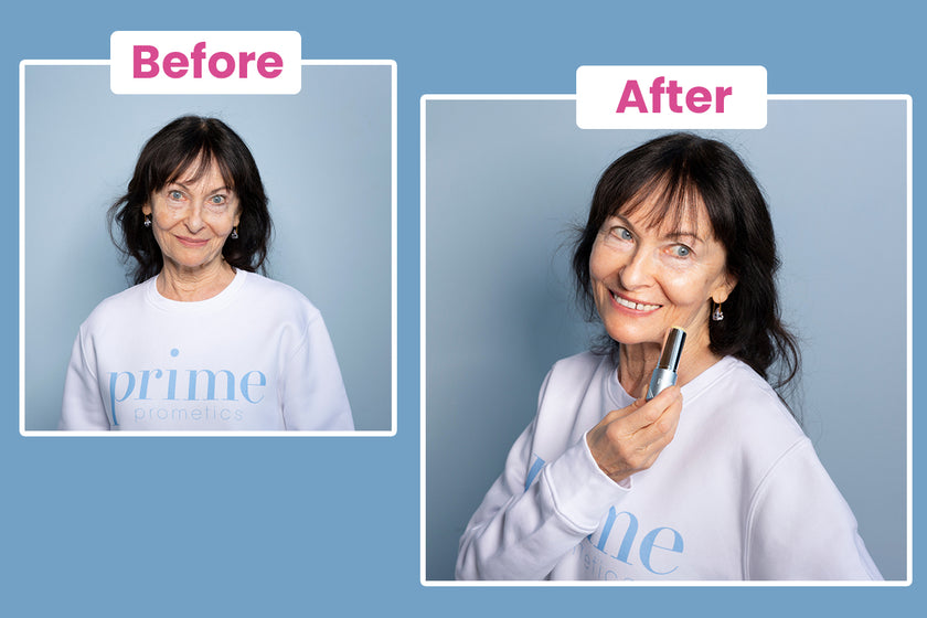 PrimeWand Nourish | PrimePrometics™