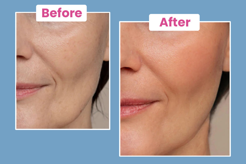 PrimeWand Nourish | PrimePrometics™