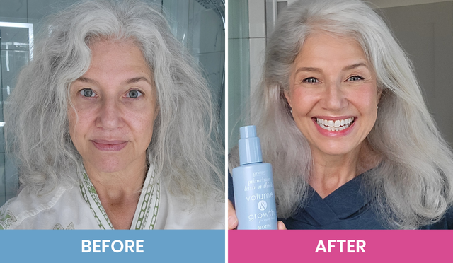 The Volumizing Radiance Bundle | PrimePrometics™