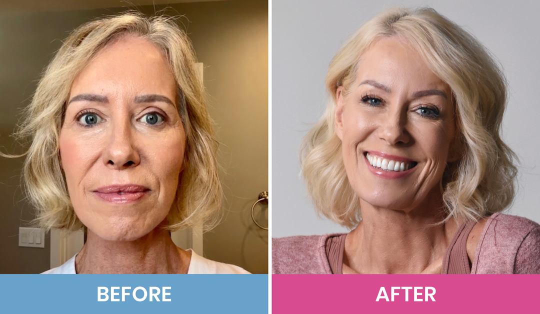 The Volumizing Radiance Bundle | PrimePrometics™